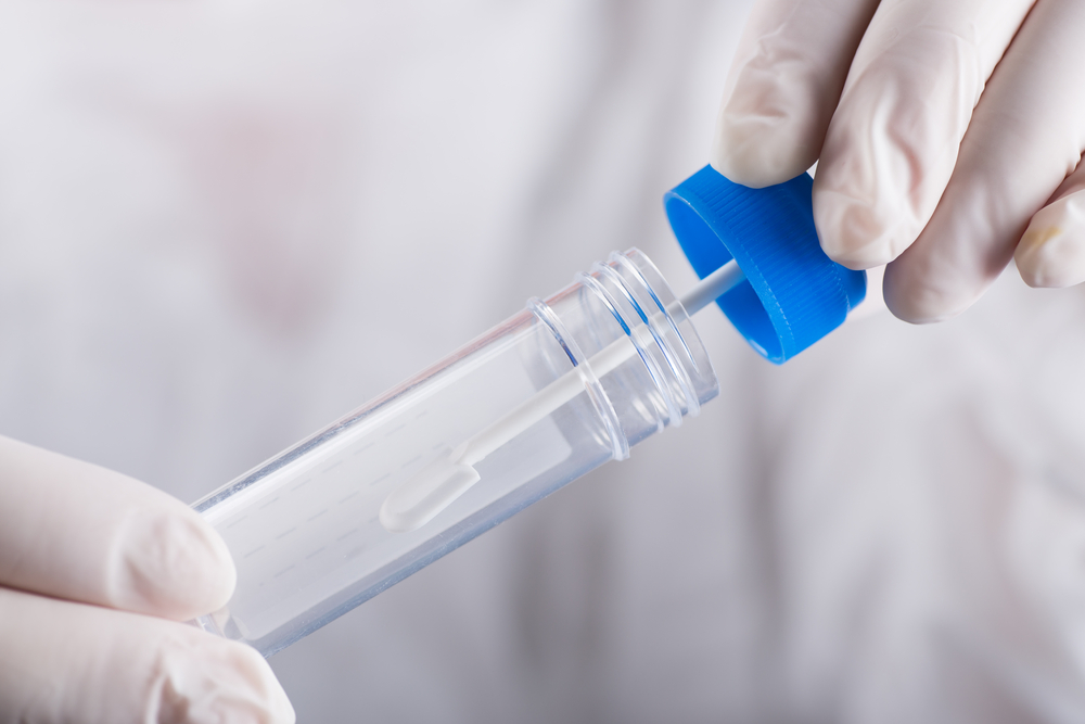 What Is Stool Guaiac Testing Nd How Is It Used 